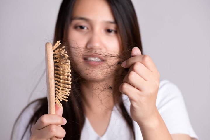 10 Tips & Cara untuk Mengatasi Rambut Rontokmu