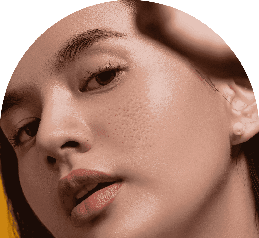 Solusi Mudah & Tepat Mengatasi Pori - Pori Besar | Diri Care