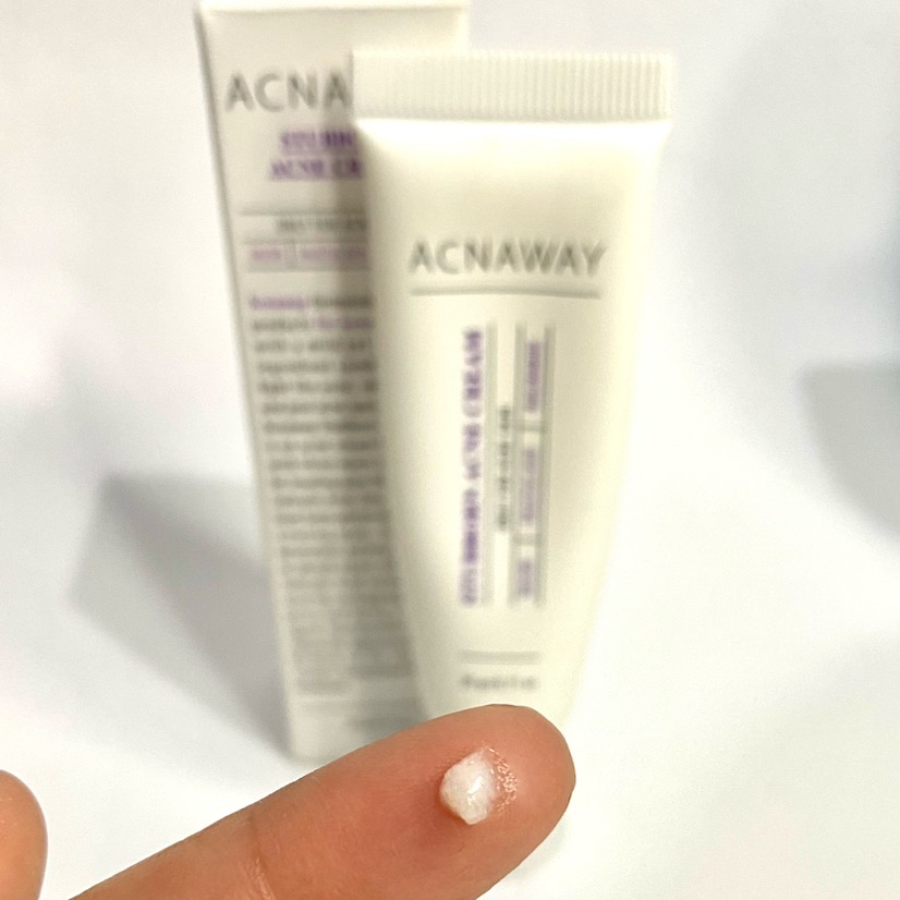 Acnaway Stubborn Acne Cream - Beauty Review