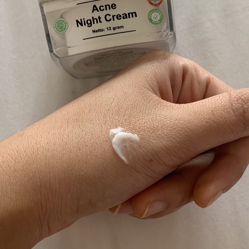 MS Glow Acne Night Cream - Beauty Review