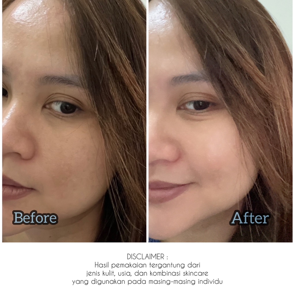 MS Glow White Cell DNA Serum - Beauty Review