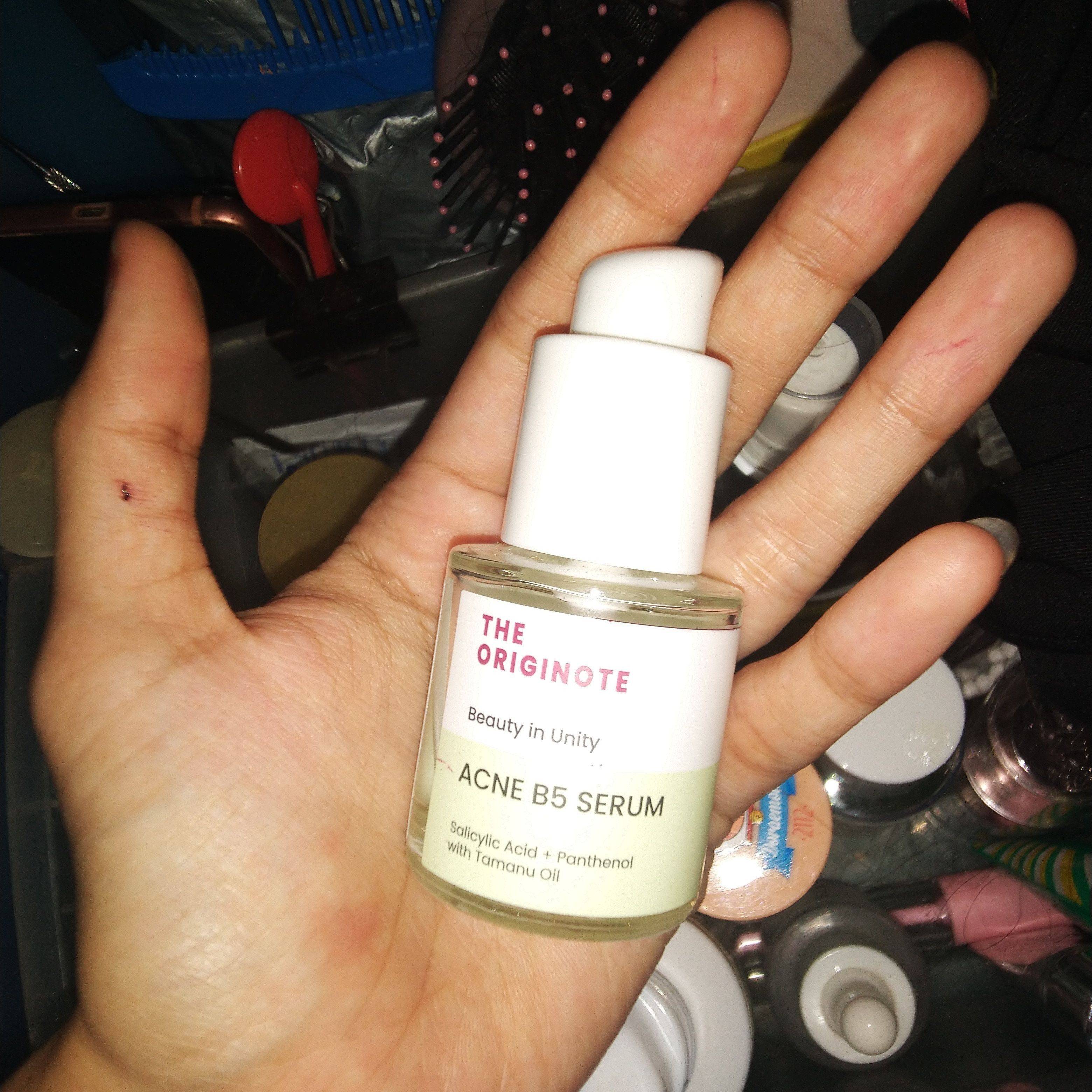 The Originote Acne B5 Serum - Beauty Review