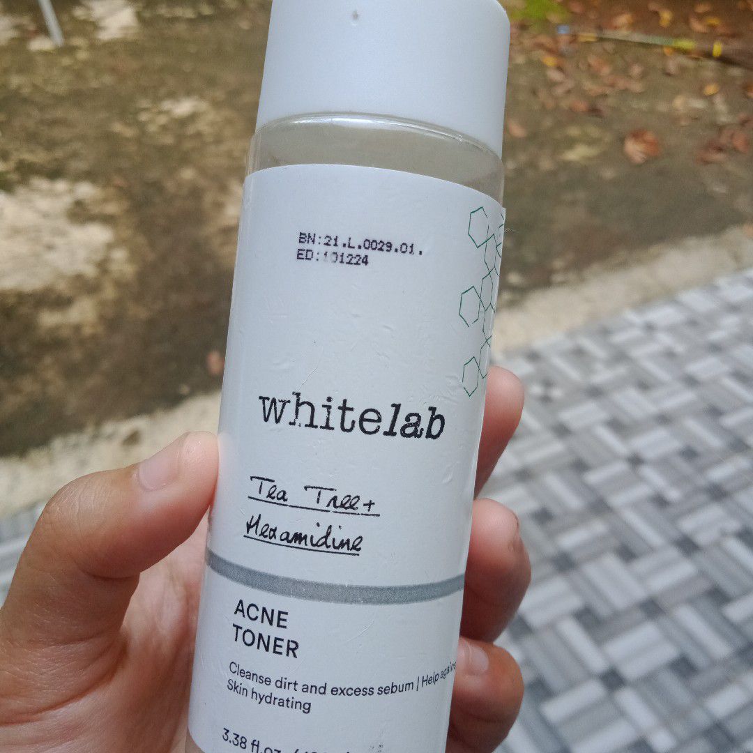 Whitelab Acne Toner - Beauty Review