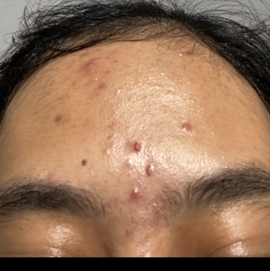 Skinmurch Multiaction Treatment Cream - Beauty Review