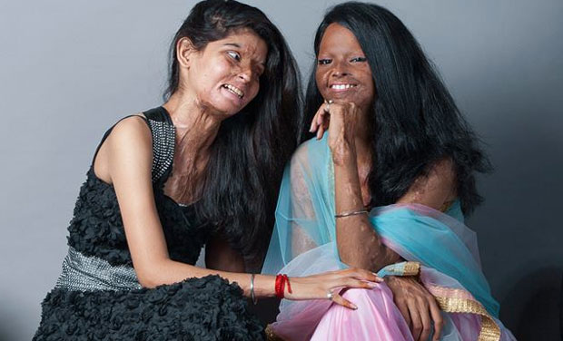 Indian acid attack victims get stunning photoshoot