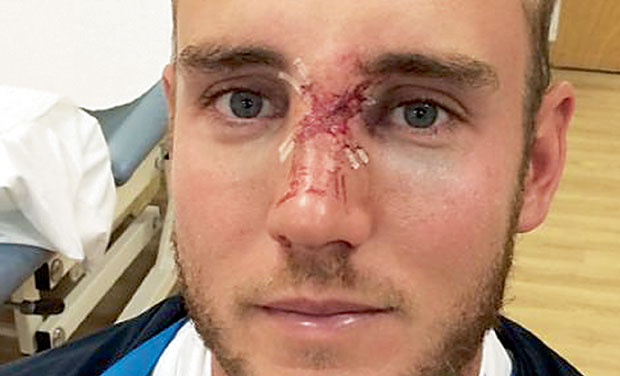Broad’s Helmet unsafe, says ex-england opener