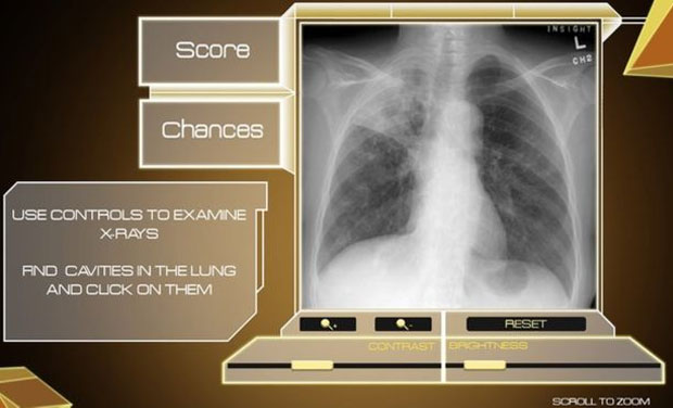 New video game battles tuberculosis