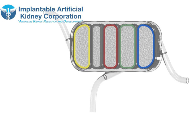 Prototype of implantable artificial kidney developed