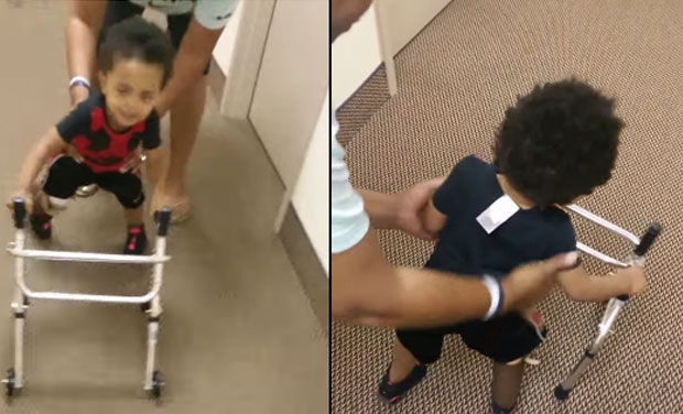 Watch: Beating all odds, toddler with amputated left leg takes his ...