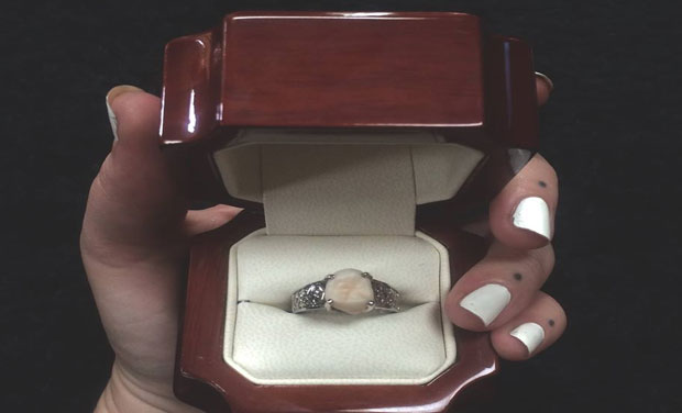 Man gifts fiancée an engagement ring made of his wisdom tooth