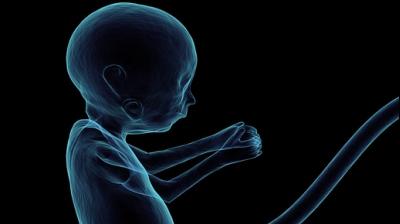 Mass thought to be tumour revealed as parasitic twin inside baby's body