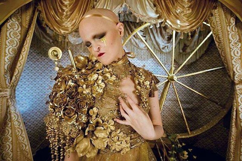 American uses rare condition to break beauty stereotypes to become model