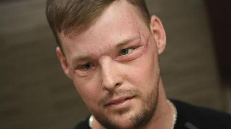 Twin tragedies give survivor a new face