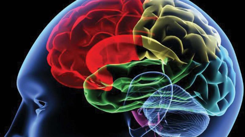 Fat deposits cause for 30 per cent of ‘brain attacks’