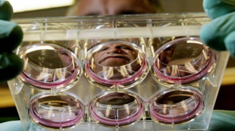 Stem Cells May Hold Key To Finding Cure For Infertility In Men Research 3750
