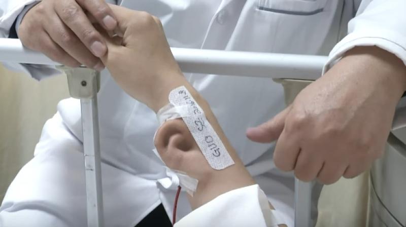 Chinese doctors grow new ear on man's arm and transplant it to his head