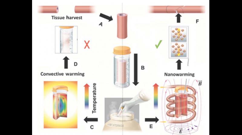 Study finds way to preserve organs longer